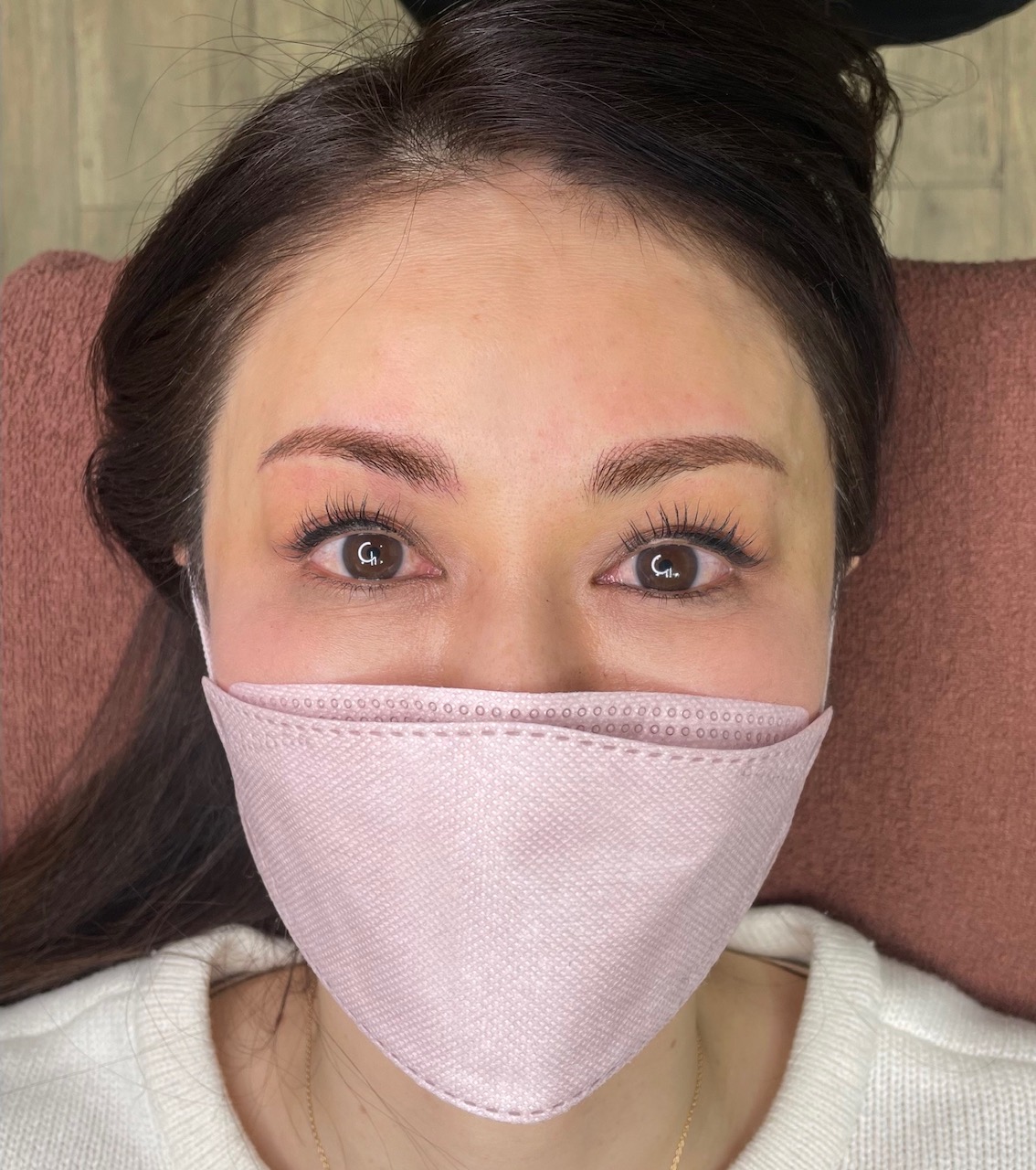 IMG_4286 | 名古屋市緑区の皮膚科・美容皮膚科はあすか皮フ科クリニックへ