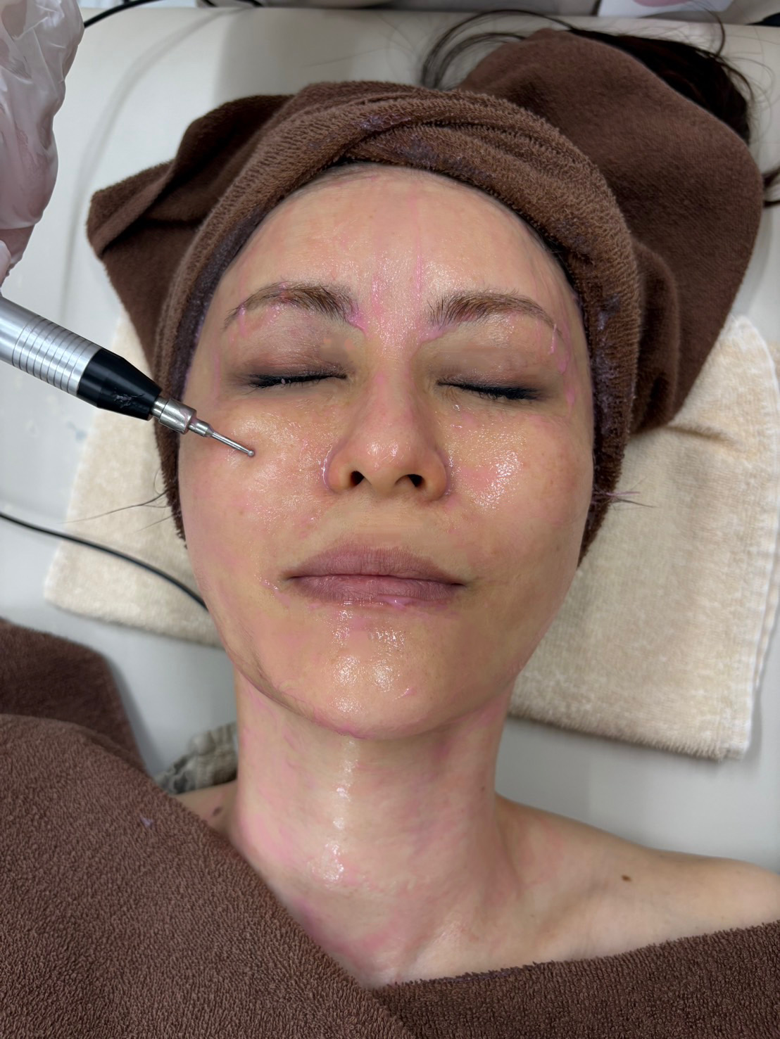 IMG_8460 | 名古屋市緑区の皮膚科・美容皮膚科はあすか皮フ科クリニックへ